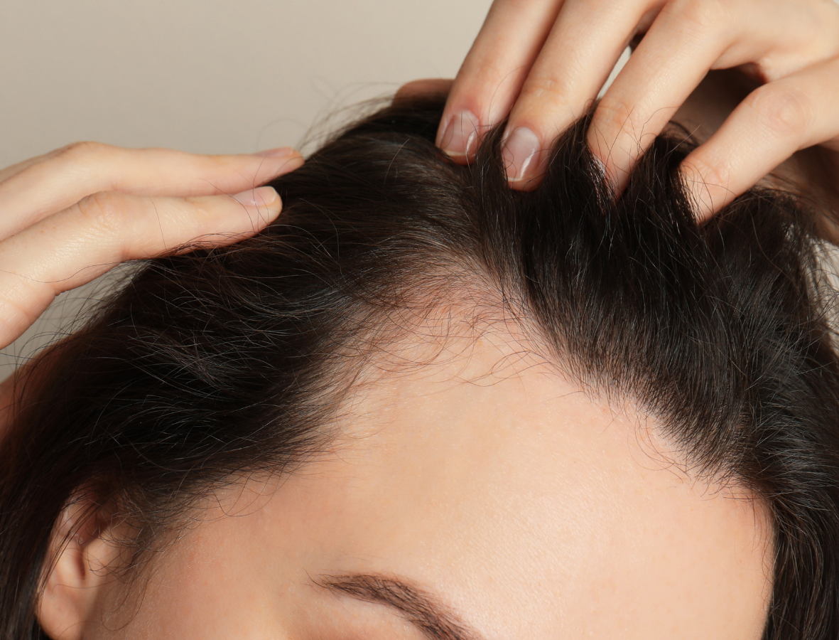 A Beginners Guide to Scalp Care – Calia Natural